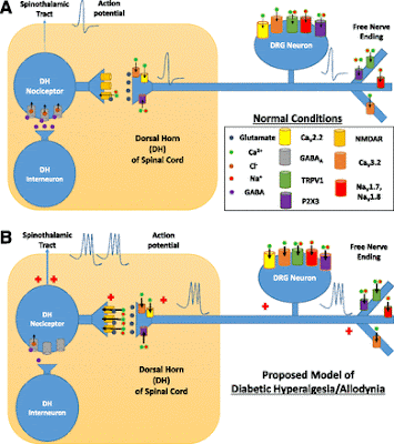 Neuromics: Pain Receptors and Diabetic Neuropathy