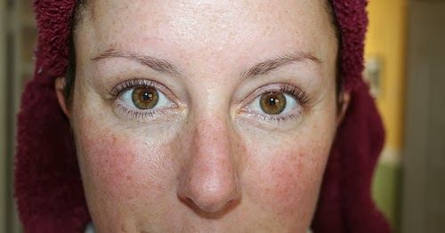 Kaylin's Kit: Ask Kaylin: Makeup for Hyperpigmentation and Rosacea