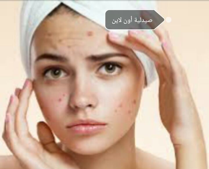 نت لوك أقراص 20 ، 40 مجم لعلاج حب الشباب Netlook