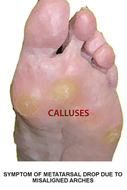Podiatry- Importance of Footcare in Diabetics: Common foot problems