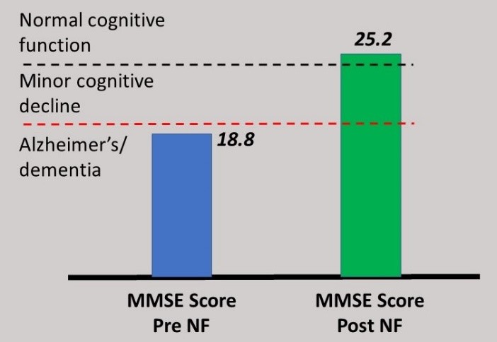 Alzheimer's Blog : Restoring Cognitive Reserve