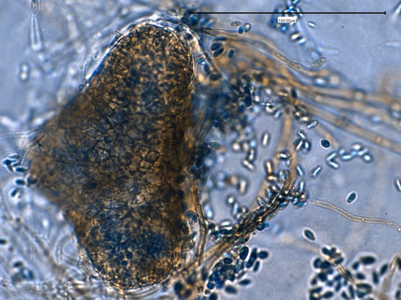 Fun With Microbiology (What's Buggin' You?): Phoma glomerata