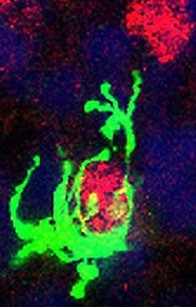 Le Cerveau de l'Enfant et de l'Adolescent: La Microglie