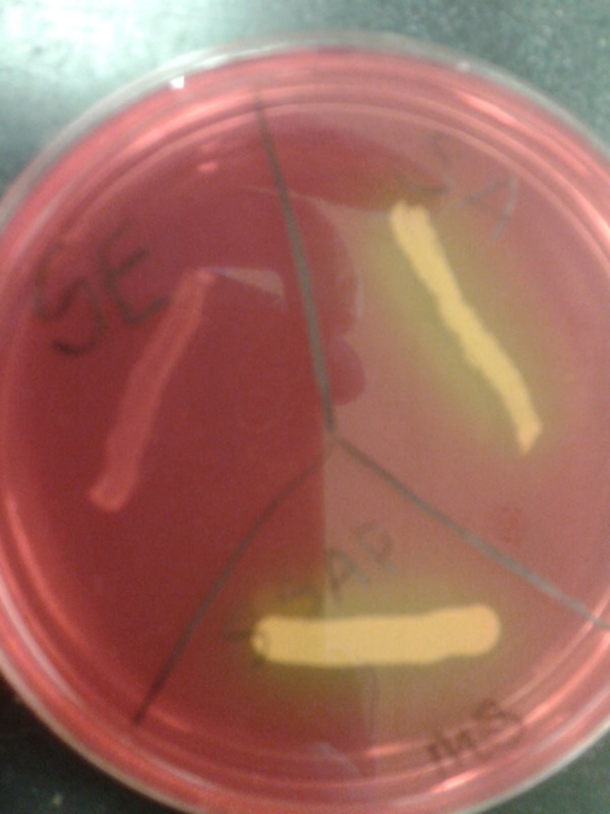 Microbiology EJournal: Day 16-Started PEA,CNA,Mannitol Salt,MacConkley ...