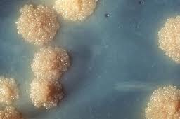 Diccionario de Epónimos: bacilo de Ducrey