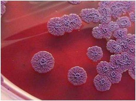 Burkholderia pseudomallei ~ dunia-mikroorganisme