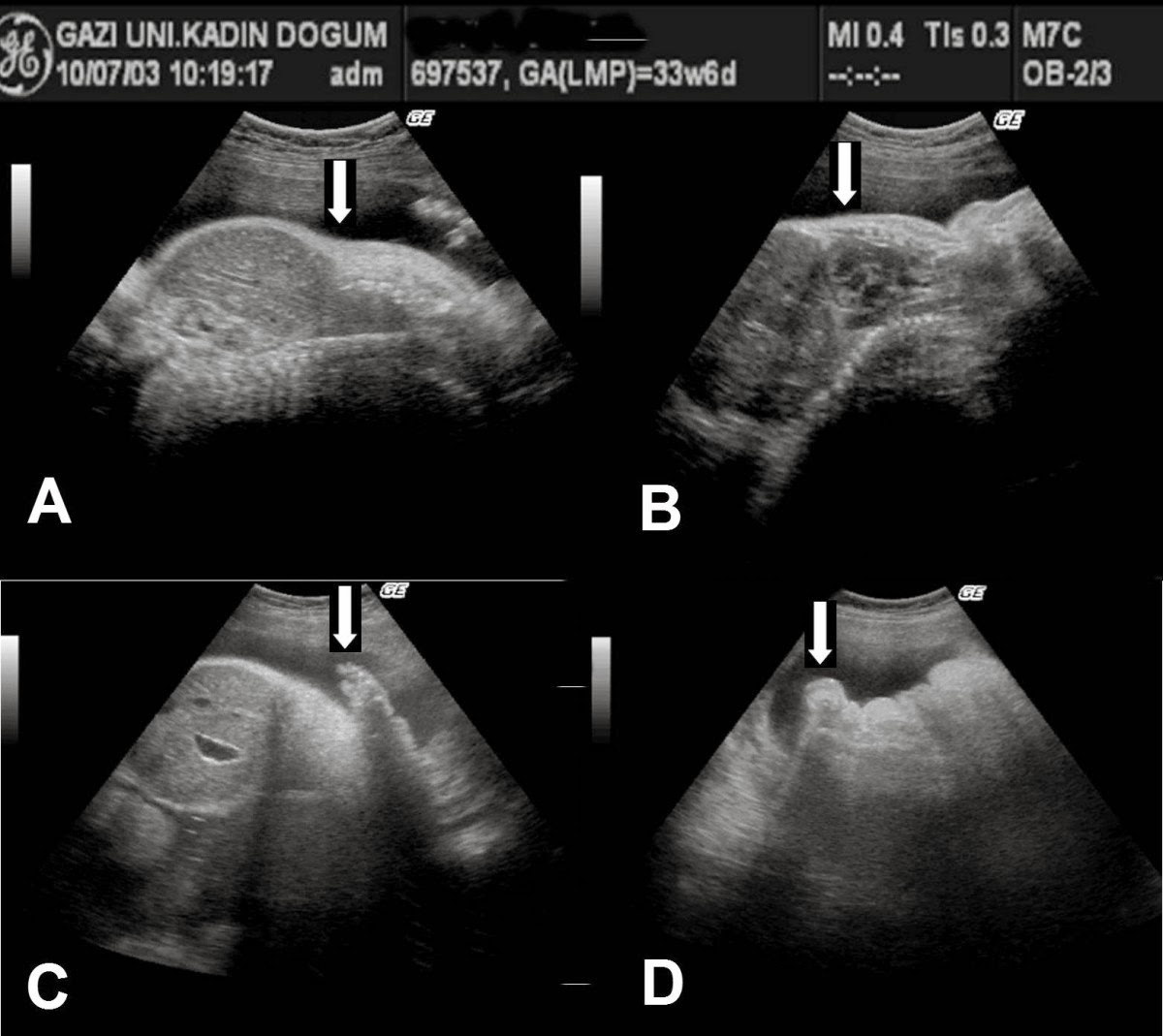 Radiodiagnostik Pemula: ULTRASONOGRAFI
