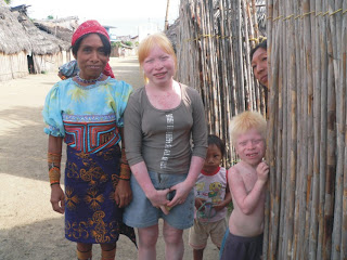 Deformutilation: Albinism Among The Kuna Indians