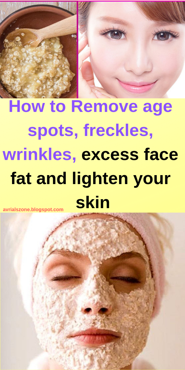 Healthy Beauty and Diet: How to Remove age spots, freckles, wrinkles ...
