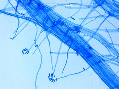 Fun With Microbiology (What's Buggin' You?): Sarocladium kiliense