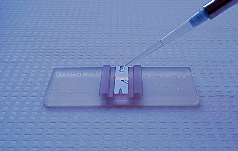 Julia's Internship at Applied Biophysics!: L-Cell dilution series and ...