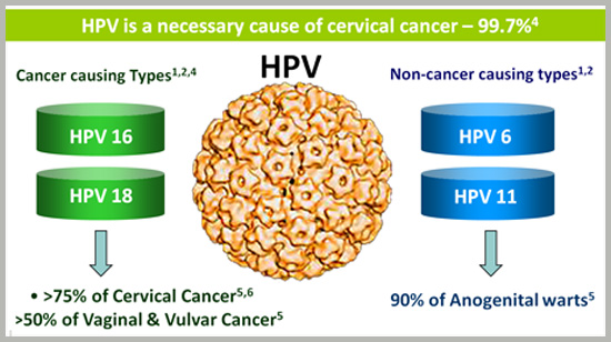 Webinar: A New Learning Aid (Pre-Invasive Cervical Lesions and Cervical ...