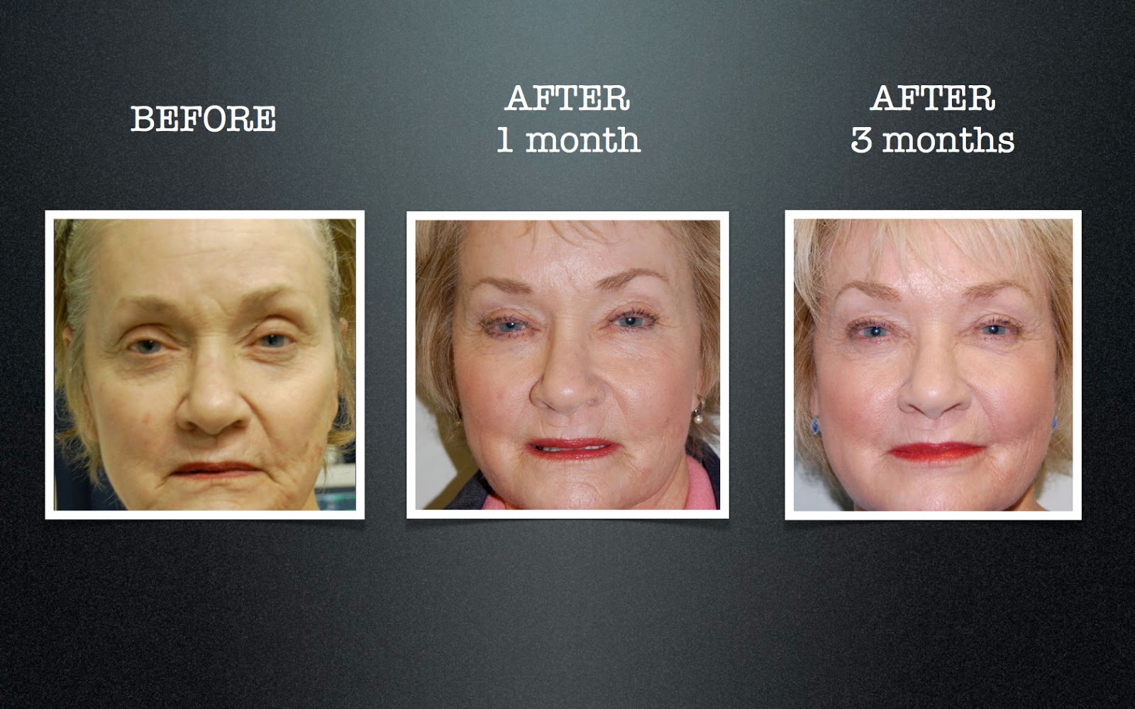 Jacksonville Plastic Surgery and Cosmetic Surgery | Breast Augmentation ...