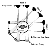 CROSS-SECTIONAL IMAGING EDUCATION HUB: GENERATIONS OF CT SCANNERS