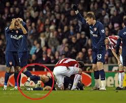 You Would Have to Be Crazy: Injuries in soccer games