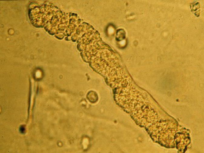 Algo de microbiología: Urocultivo:protocolo de rutina