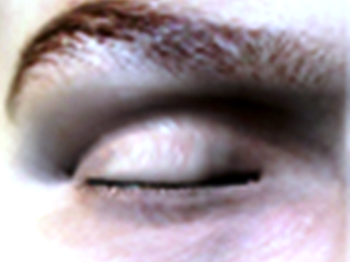 Banco Terminológico: Red trabecular