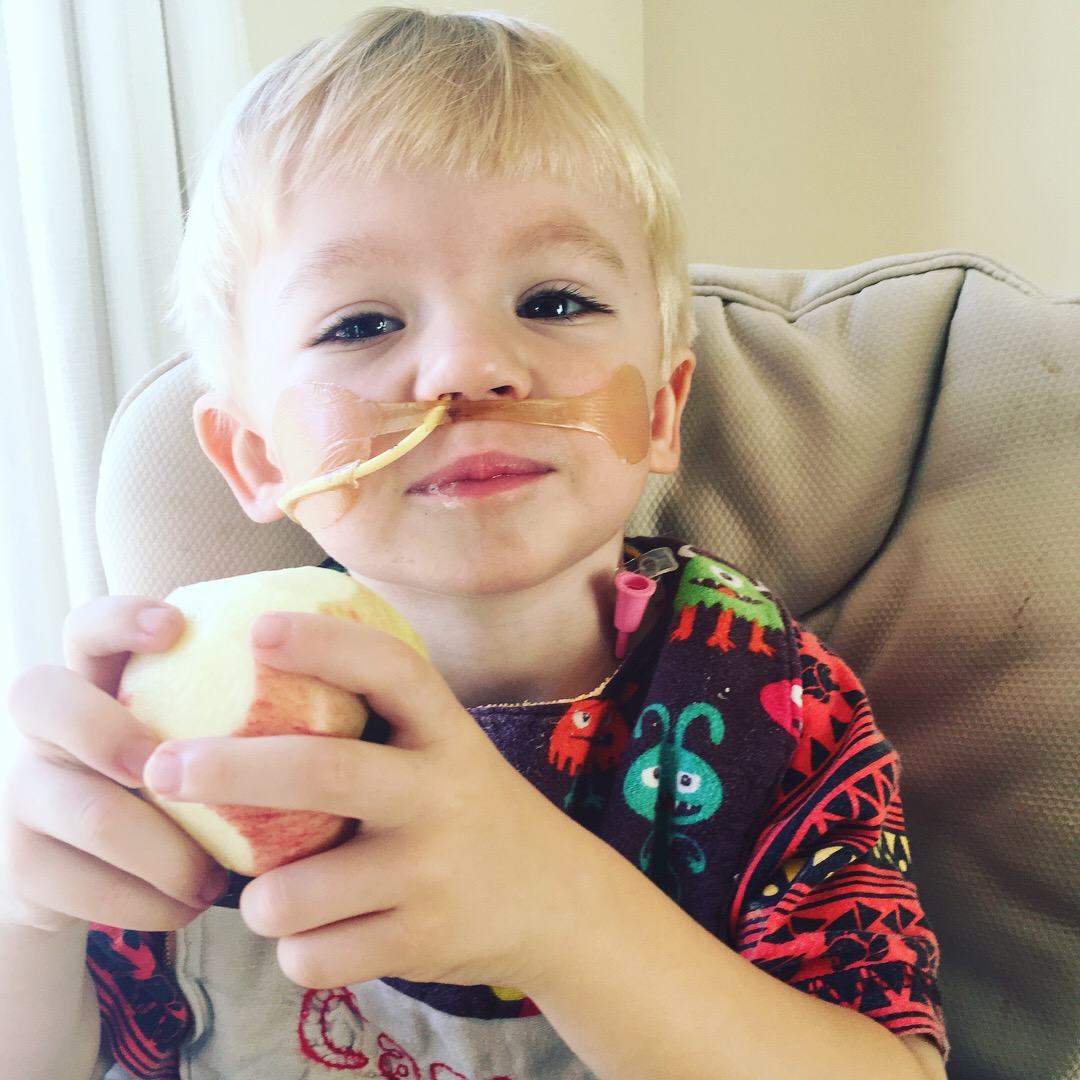 LeMastering Motherhood: Tube Feeding 101: NG Tubes