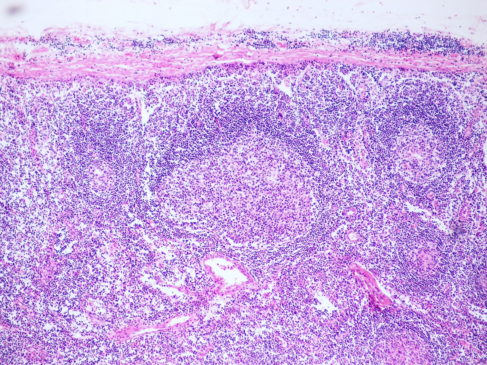 SOS BIOLOGIA CELULAR Y TISULAR: ORGANO LINFOIDE
