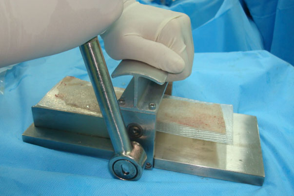 Curso de Cirugía Plástica CiruplasMedia: Injerto de Piel