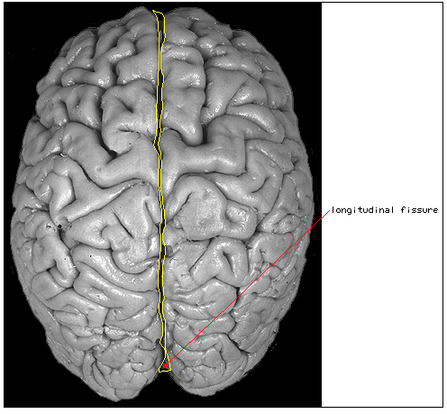 Atlas de neuroanatomía: FISURAS, SURCOS Y GIROS