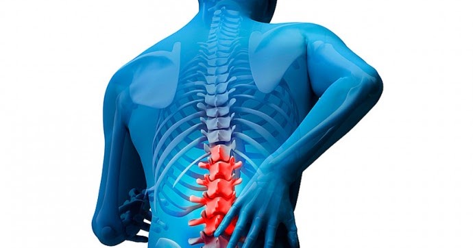 Lumbalgia | Diagnostico Medico