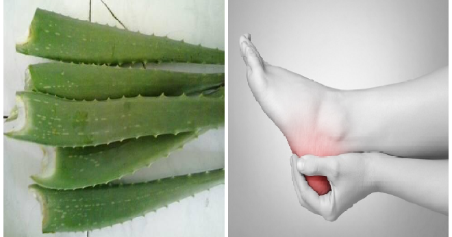 Sering Sakit dan Nyeri Pada Tumit Kaki?? Gak Usah Khawatir, Ini Dia ...