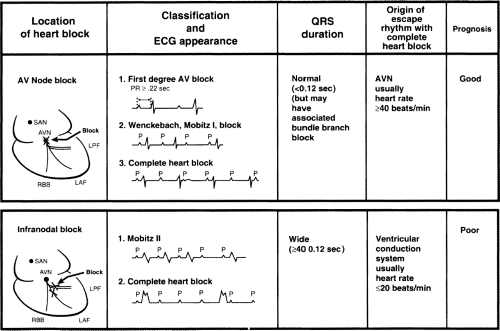 Dr Han Naung @ Henry Han : Electrophysiology and Heart Rhythm : Bundle ...