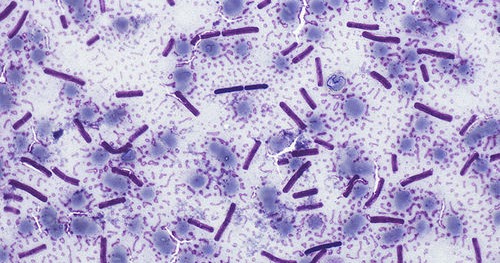 Bacillus anthracis (Anthrax) - Microbiology Laboratory Turkey