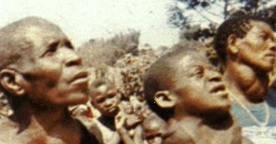 Noijan liikunta: Määrittämätön atoksinen struuma