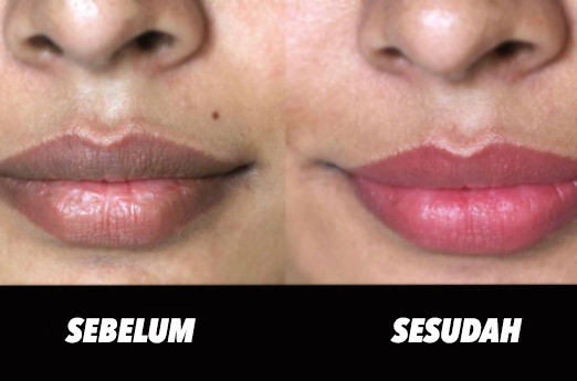 Dengan Cara Ini Anda Bisa Mendapatkan Bibir Merah Merona Hanya Dalam ...