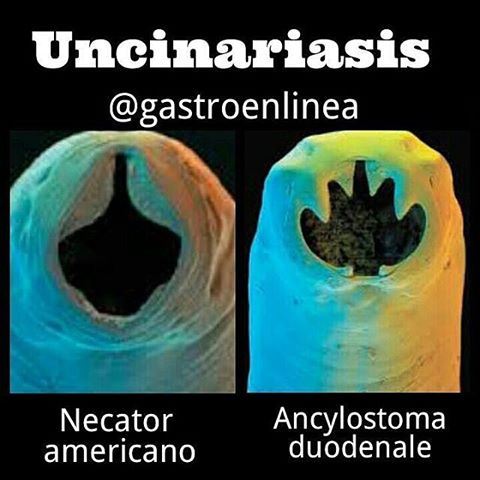 Uncinariasis O Anquilostomiasis Informacin Prctica