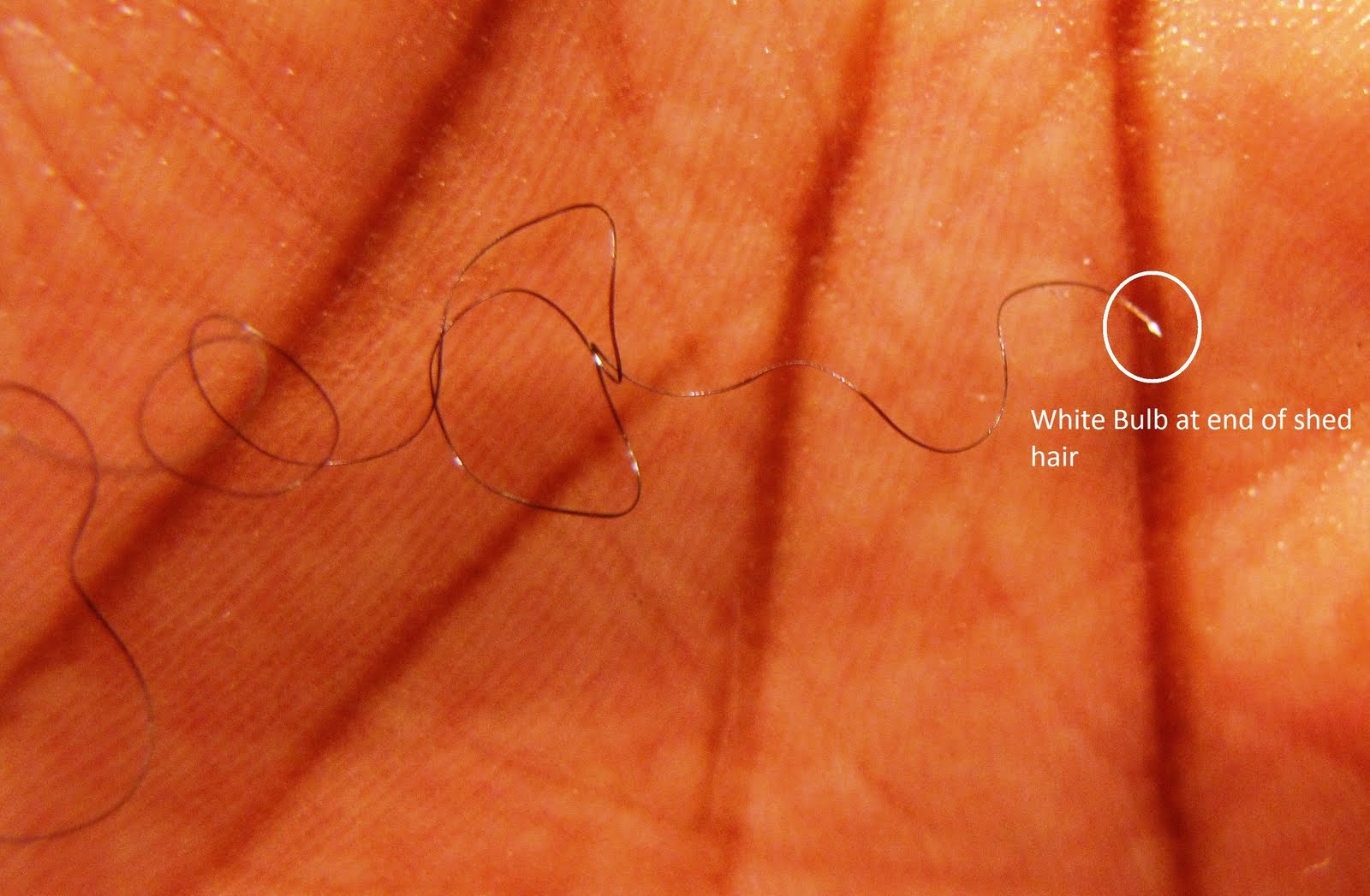 Breakage Vs Shedding Part 1. - KL's Naturals