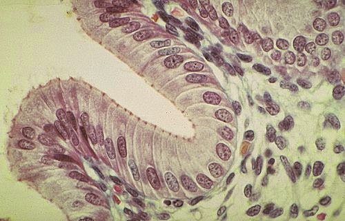 Épithélium de revêtement Cours | Bio faculté