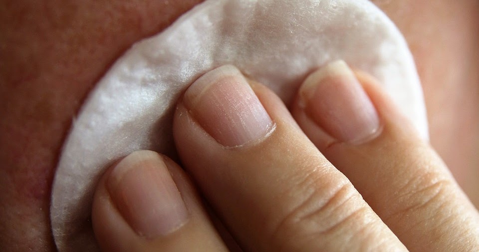 How To Get Rid Of Black Patches On Skin By Home Remedies Health And how-to-get-rid-of-black-patches-on-skin-by-home-remedies-health-and