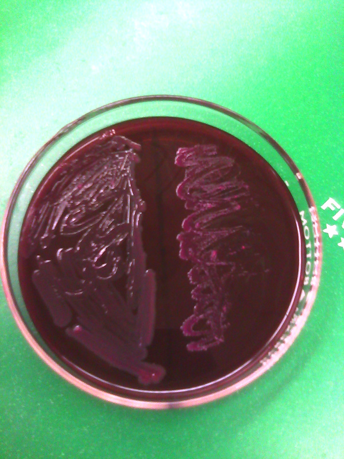 Microbiology Lab: Lab 10/27: Mannitol, MacKonkey, EMB tests