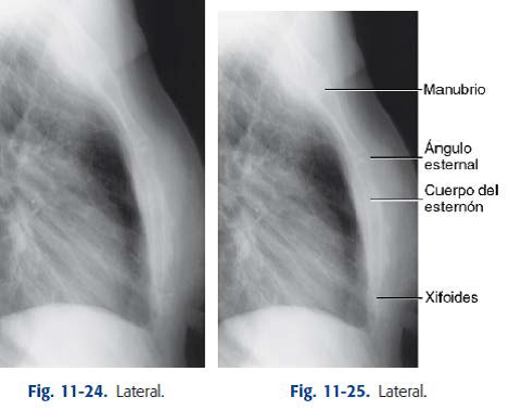 PRODUCCION Y TRATAMIENTO DE IMAGENES DIAGNOSTICAS: CAPITULO TÓRAX OSEO ...