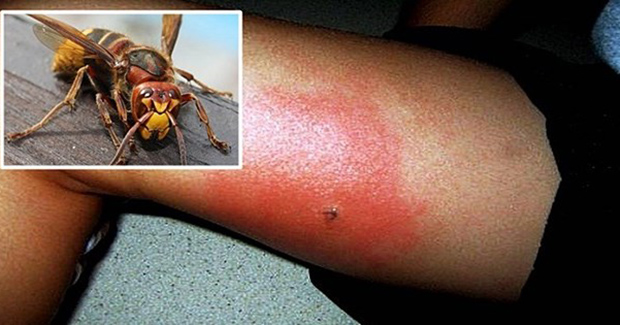 DOBRO JE ZNATI: KADA VAS UBODE OSA, STRŠLJEN ILI PČELA – OVO ĆE VAS ...