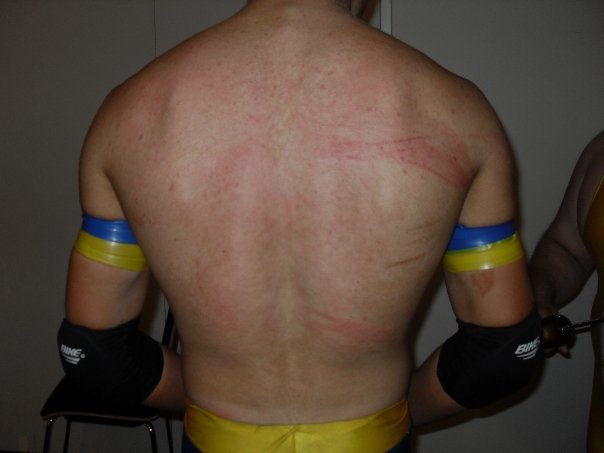 isleofslingers: Axel Impact - the marks of a champ