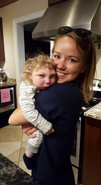 Photos: Jaxon Buell Strong, Baby Born With Half Skull Marks 2nd ...