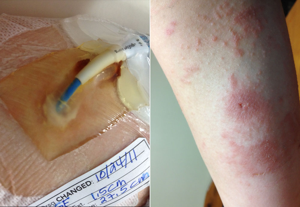 It's a crazy (good) life...: My HG Story