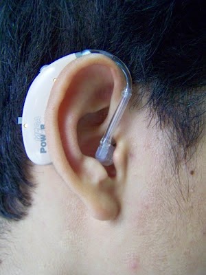 PENGERTIAN TUNARUNGU - Kumpulan Materi