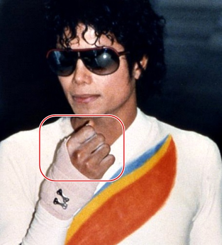 Cartas para Michael: Lúpus e vitiligo, dois desafios para Michael Jackson