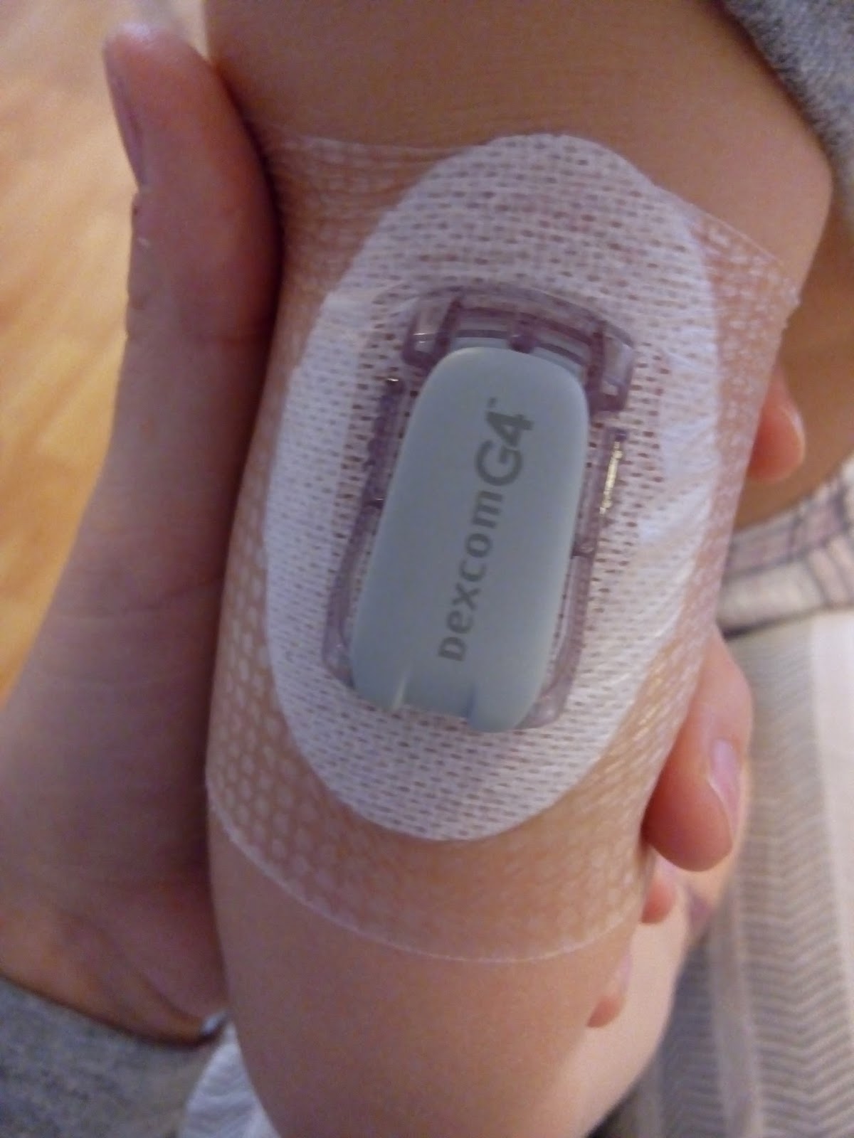 midulcenerea: Probando DEXCOM