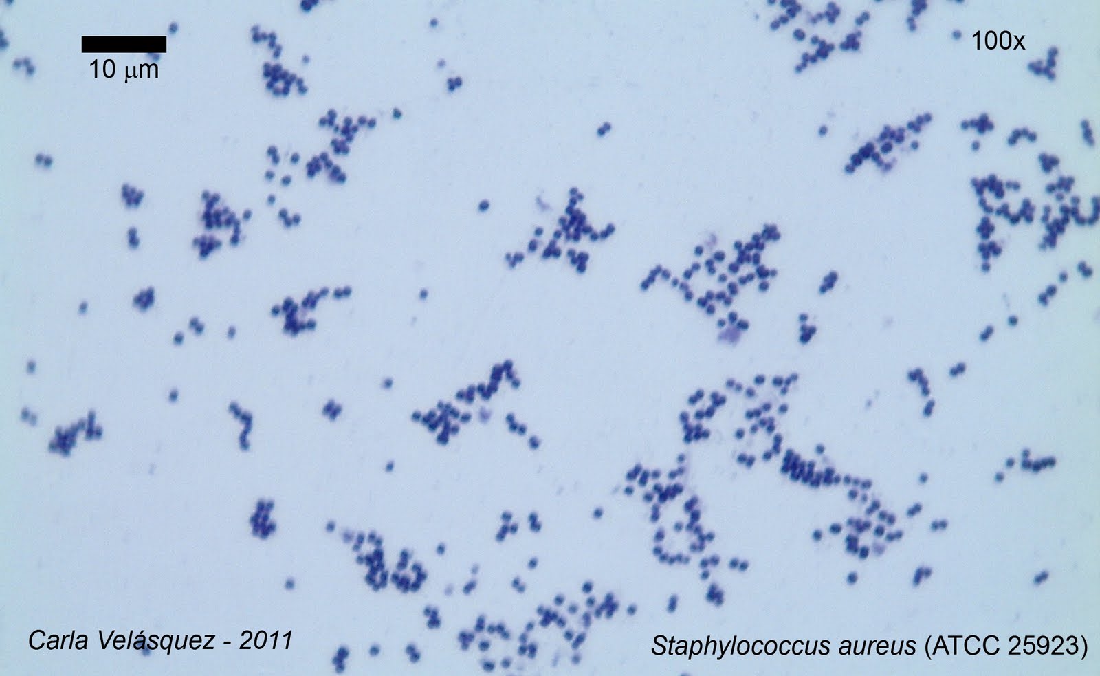 Bacterias al microscopio: Staphylococcus aureus