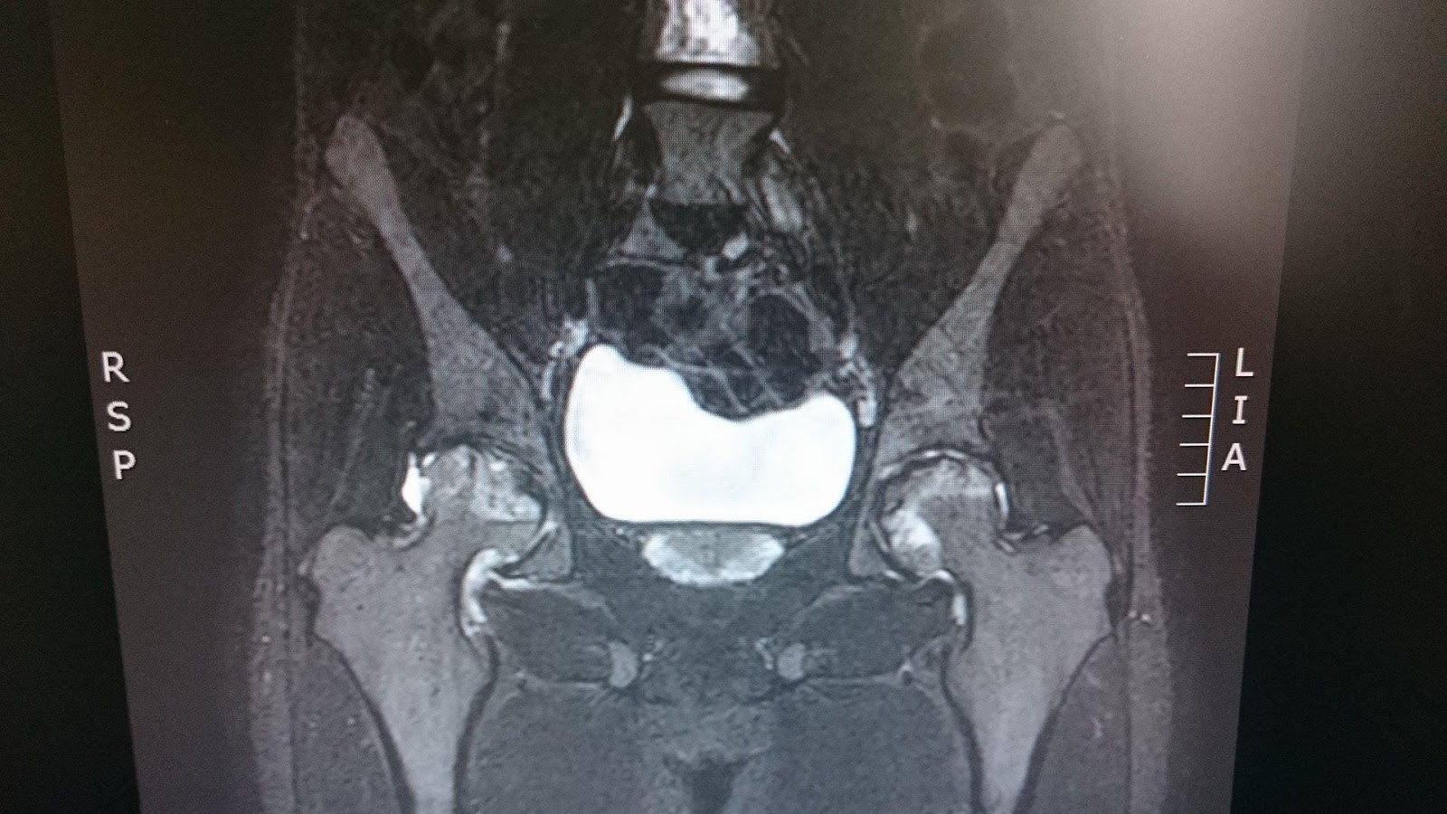 EL RINCÓN DE LA MEDICINA INTERNA. juanpedromacaluso@yahoo.com.ar ...