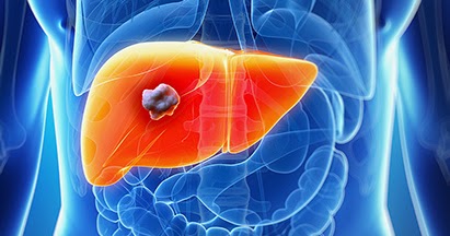 Boererate.com: Lewerkanker