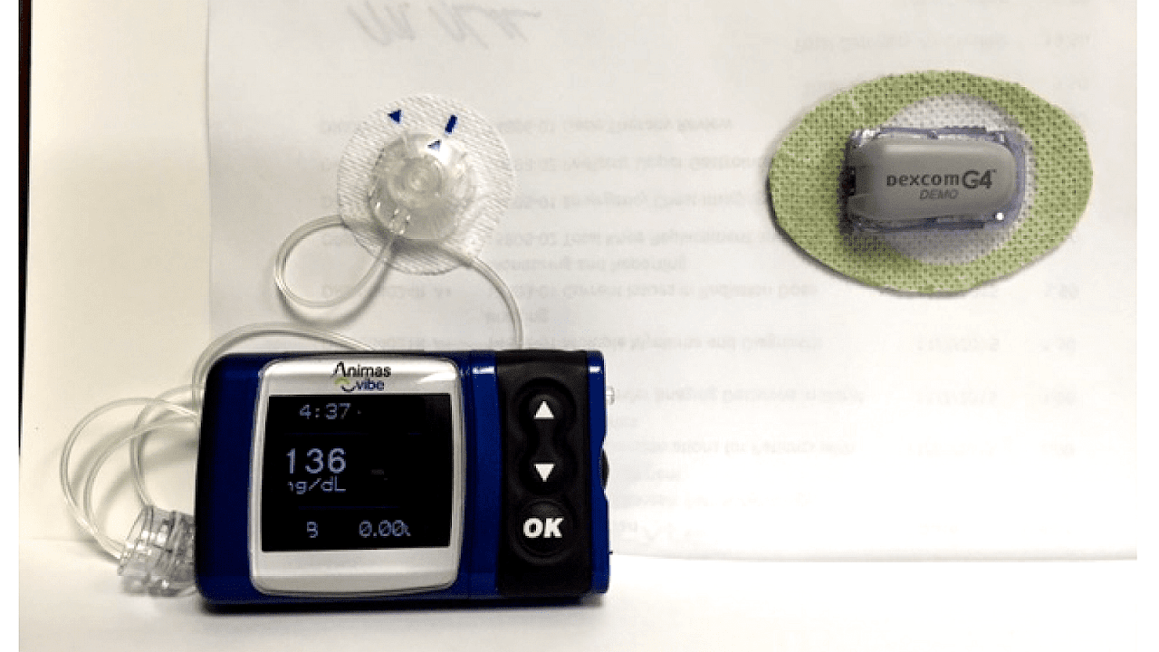 Insulin Pump Brands - Brand Choices