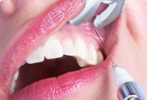 Omni Dental Group: Dental Injection