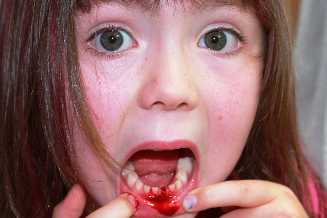 Life With the Georges: I Would Surmise the Arrival of the Tooth Fairy ...